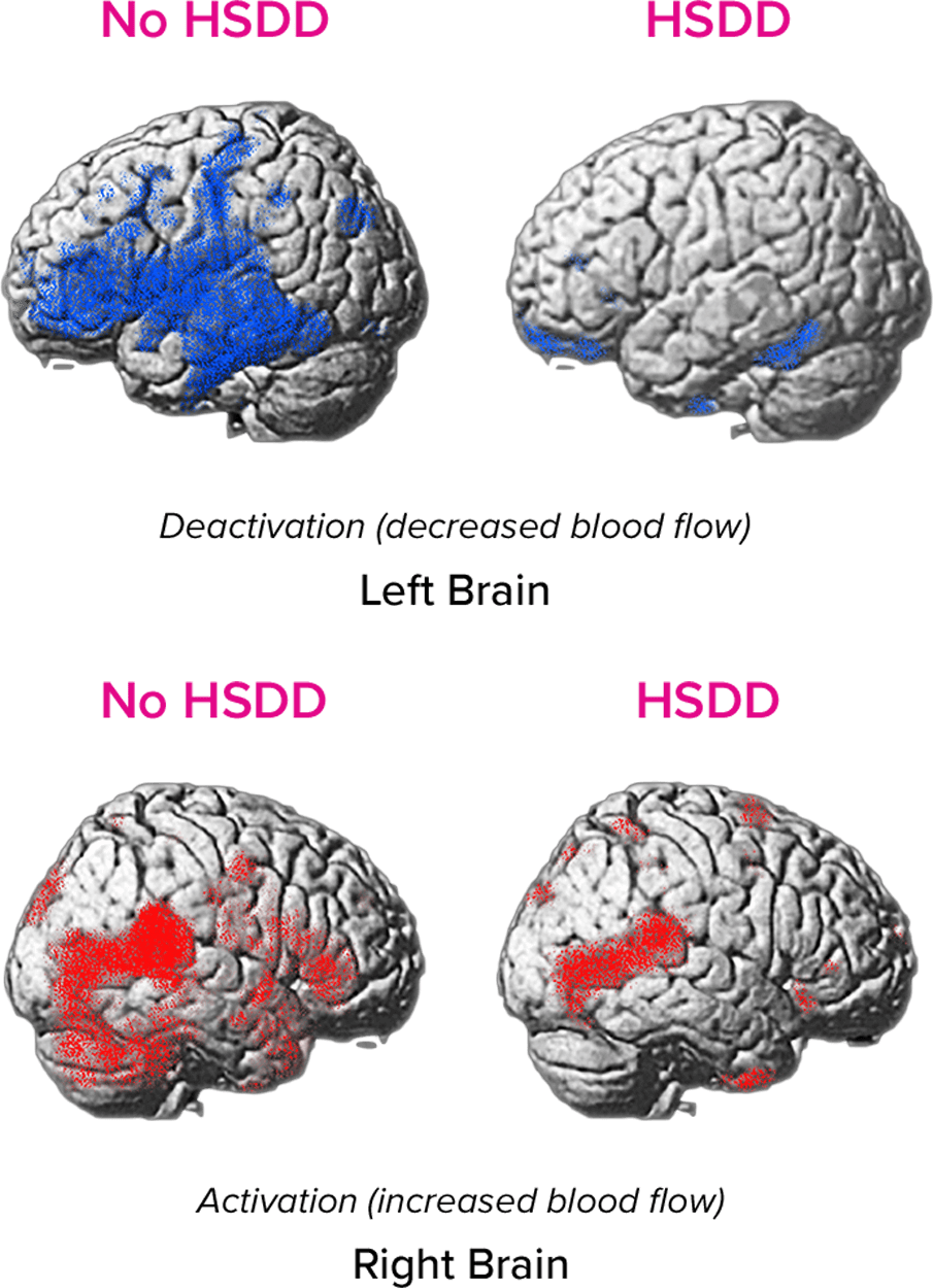 Addyi (flibanserin) HCP | About HSDD